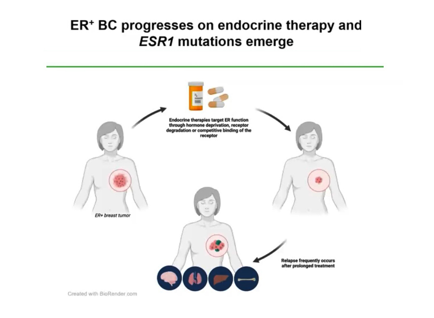 Positive preclinical data presented at AACR 2023 - etira